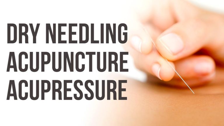 Dry Needling vs Acupuncture vs Acupressure for Pain Relief - Coach ...