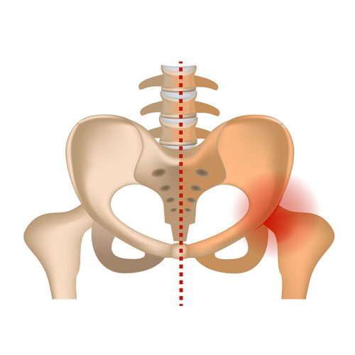 Do You Have Hip Dominance Where One Side Does More? - Coach Sofia Fitness