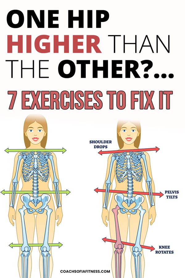 7 Exercises to Fix Uneven Hips (When One Hip is Higher Than The Other ...